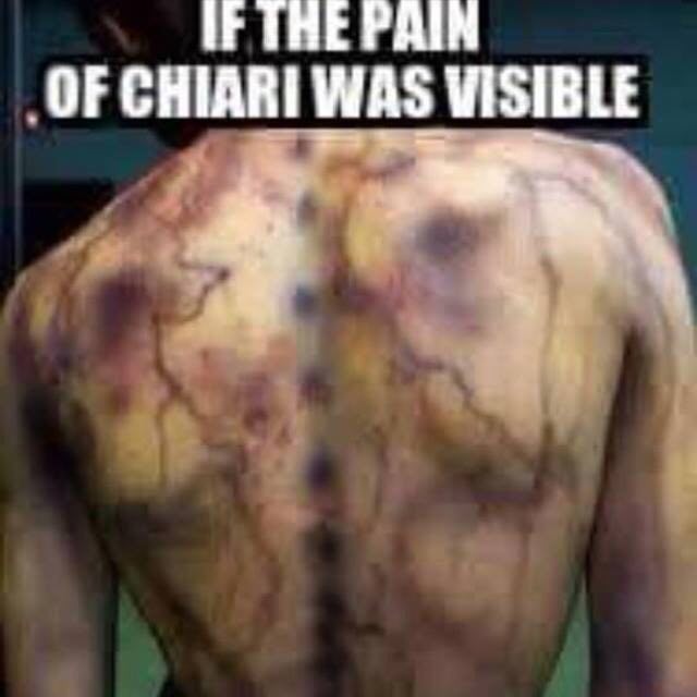 Chiari Malformation Awareness Month 2022. – Brain disorders & other ...